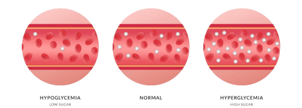 Hyperglycemia: Symptoms, Causes, and Treatments | Insulin store